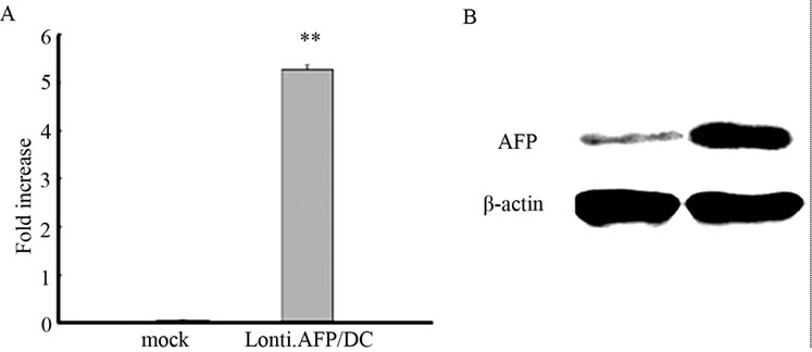 AFP特异性肝癌疫苗抑制肝细胞癌生长 AFP Specific Liver Tumor Vaccines Inhibit ...